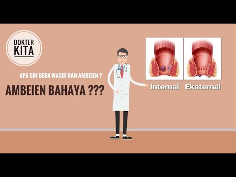 APA SIH BEDA WASIR DAN AMBEIEN ?! BAHAYA GAK ? CEK YUK! #DOKTERKITA ...