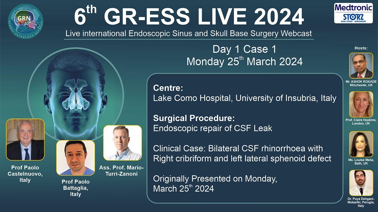 Spring GR-ESS -Live 2024 Day 1 case 1, CSF Rhinorrhoea Closure by Prof ...