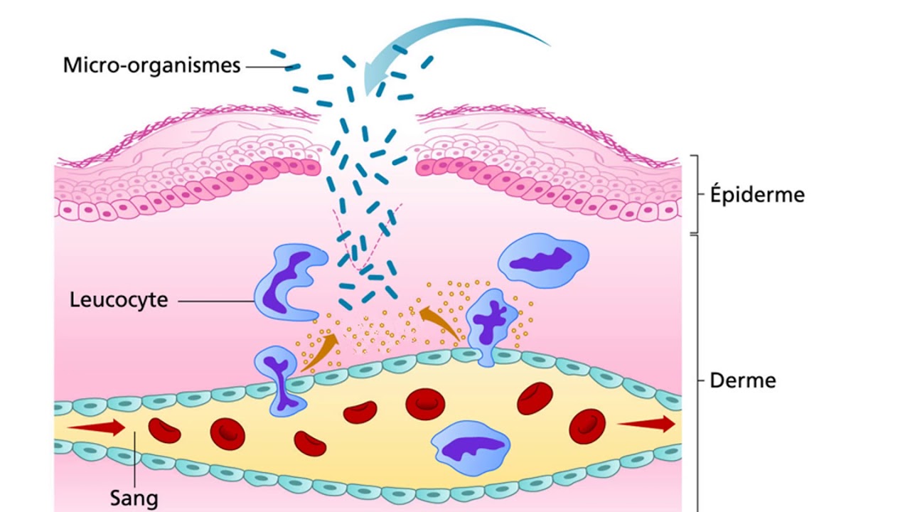 La réaction inflammatoire aigüe - YouTube