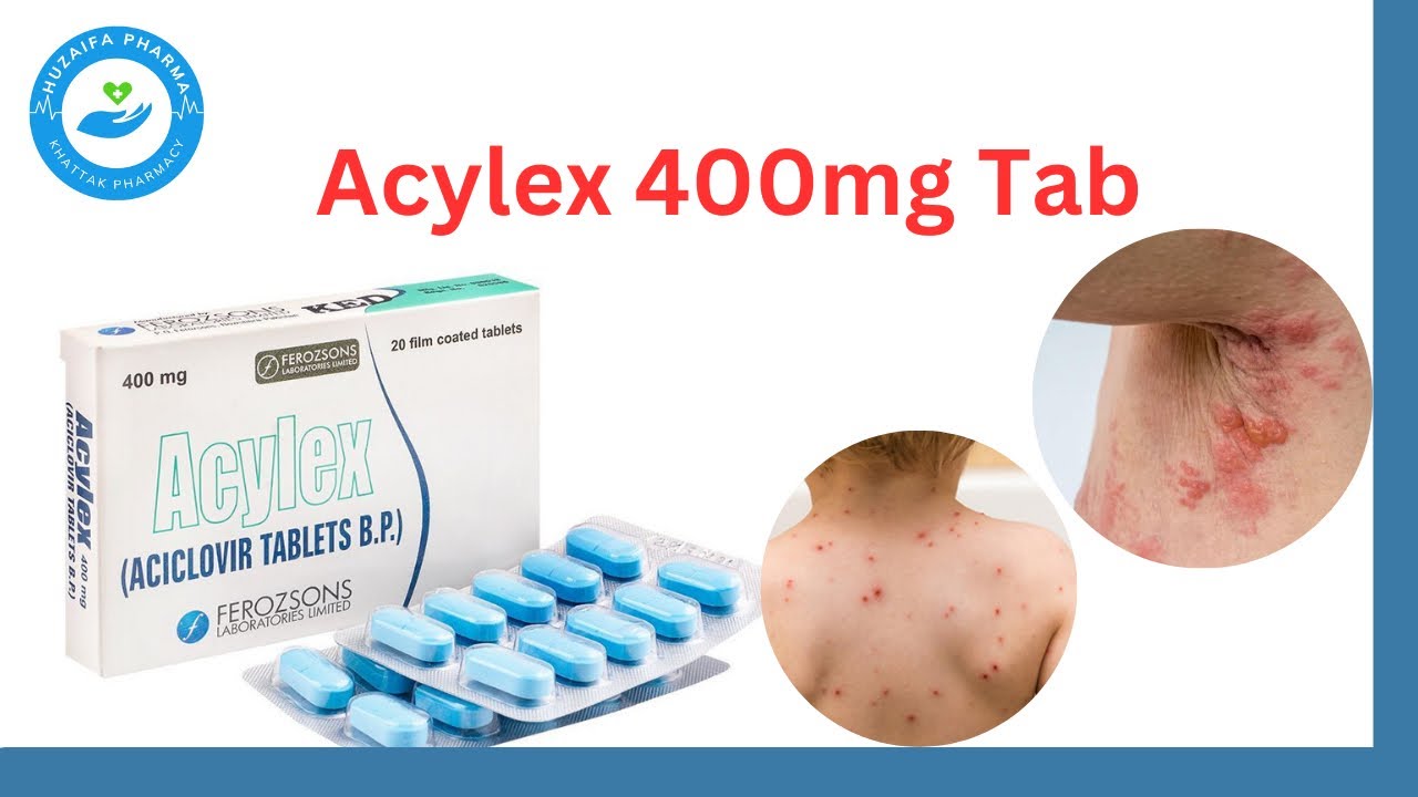 Acylex (Aciclovir) Tablet Uses In Urdu/Aciclovir |Acyclovir | Herpes ...