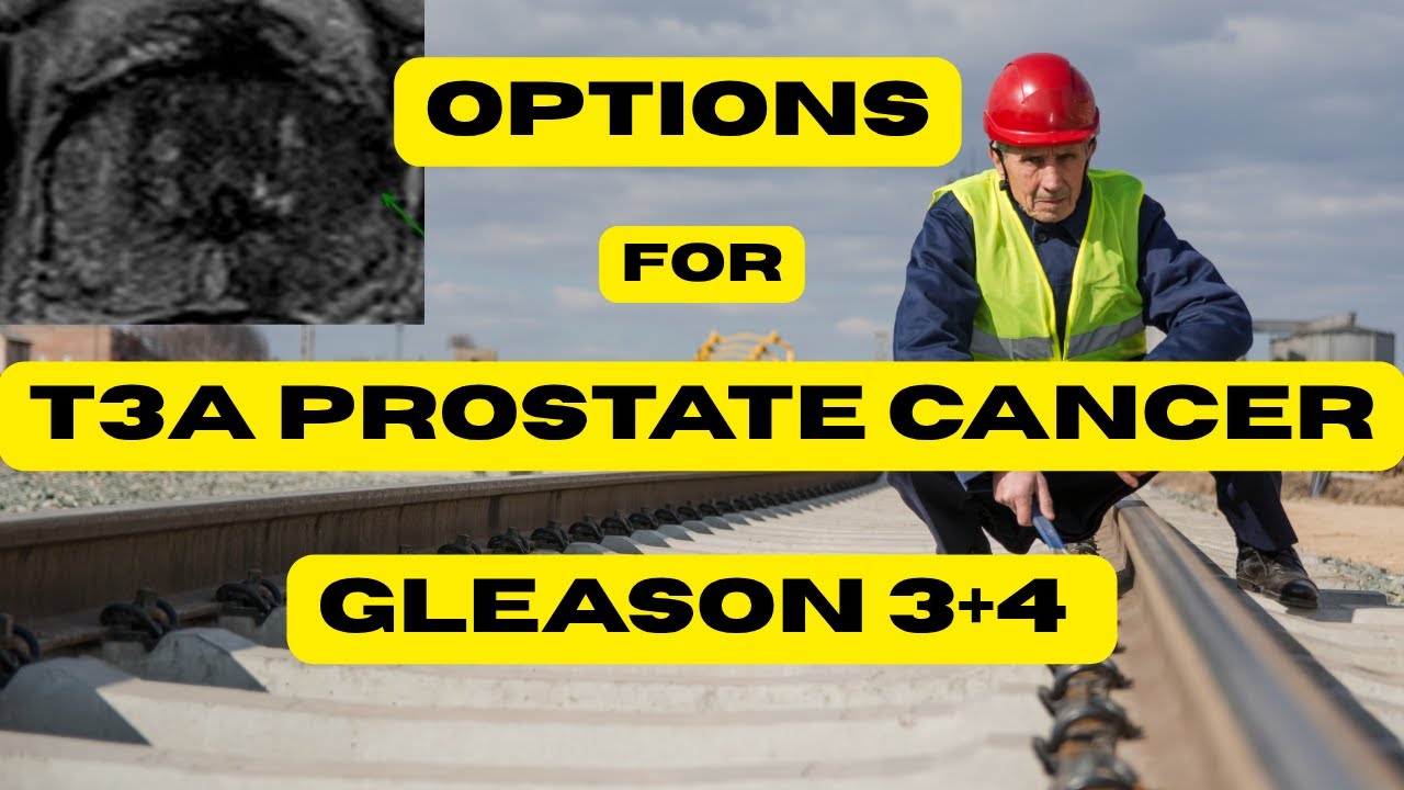 Stage T3a, Gleason 3+4 Prostate Cancer, Treatment Options! - YouTube
