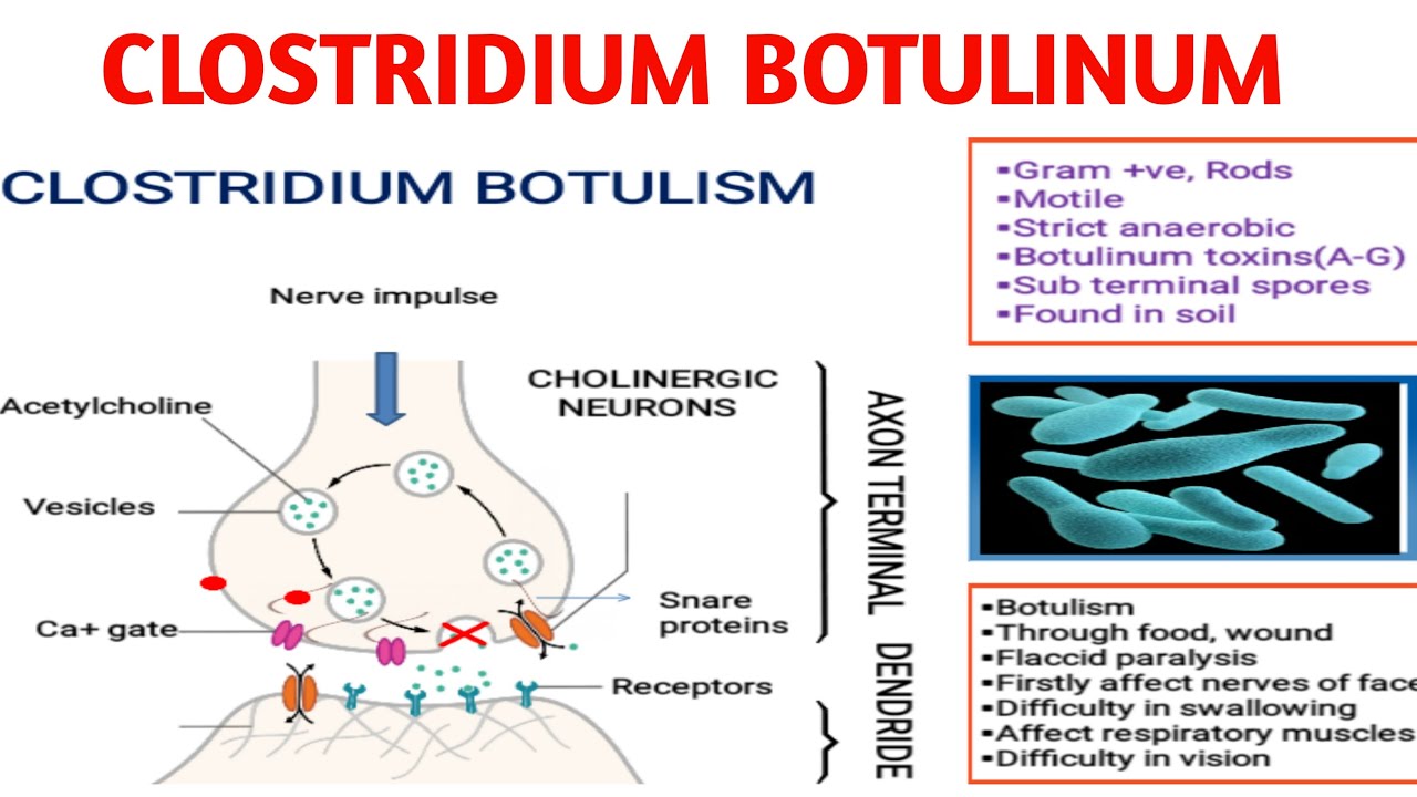 Clostridium Botulinum Diagram