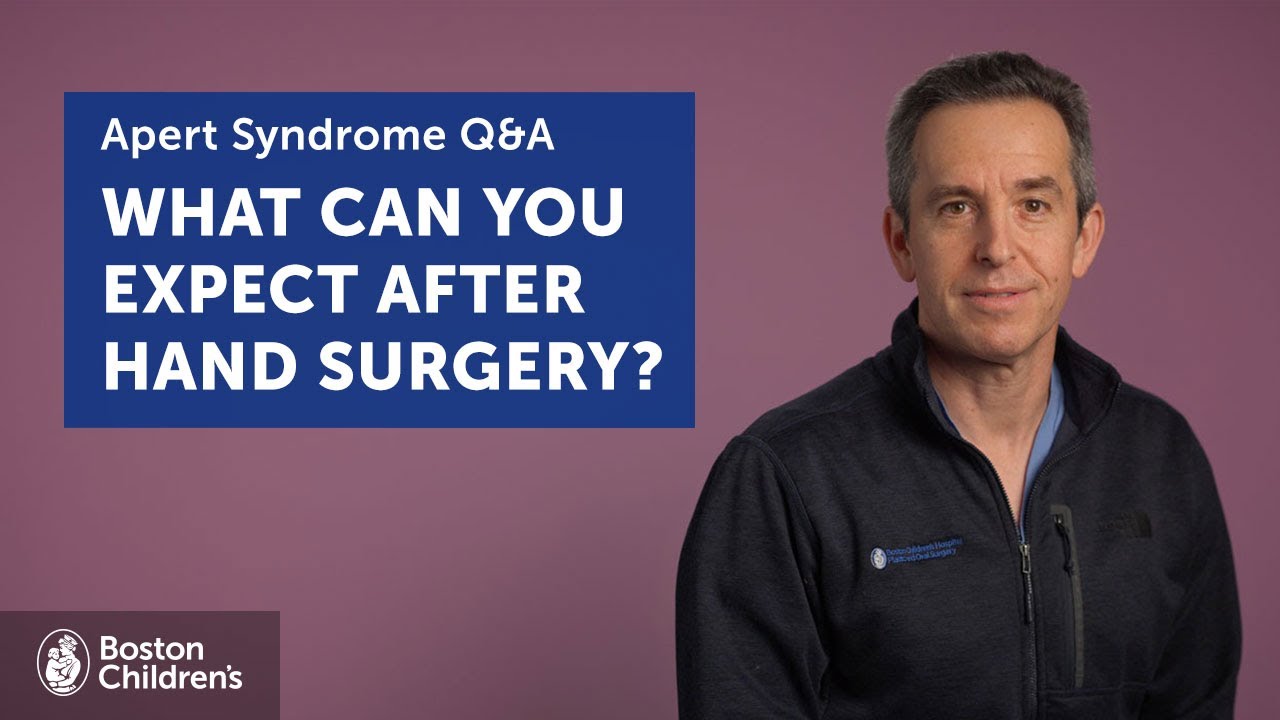 What can Apert syndrome patients expect after hand surgery? | Boston ...
