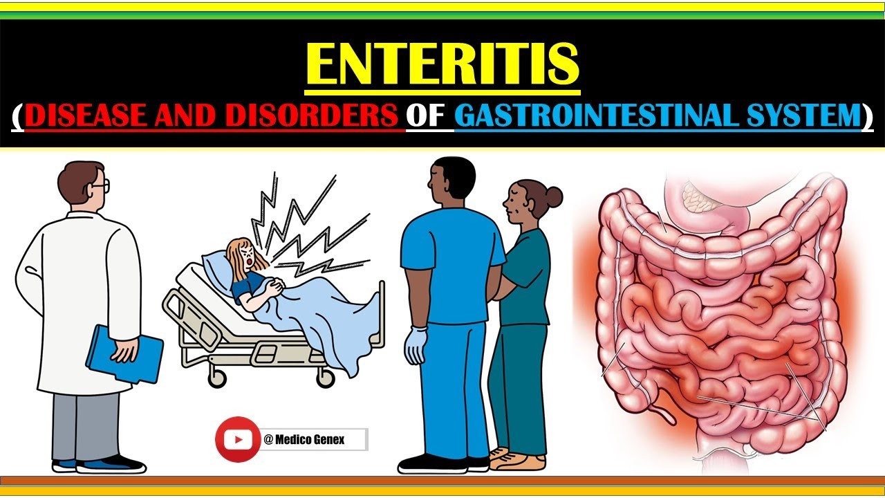 ENTERITIS | CAUSES OF ENTERITIS | SIGN AND SYMPTOMS OF ENTERITIS ...