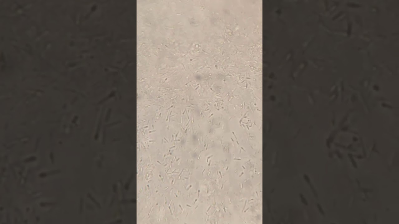 Highly motile rods under the microscope - Veterinary Video - YouTube