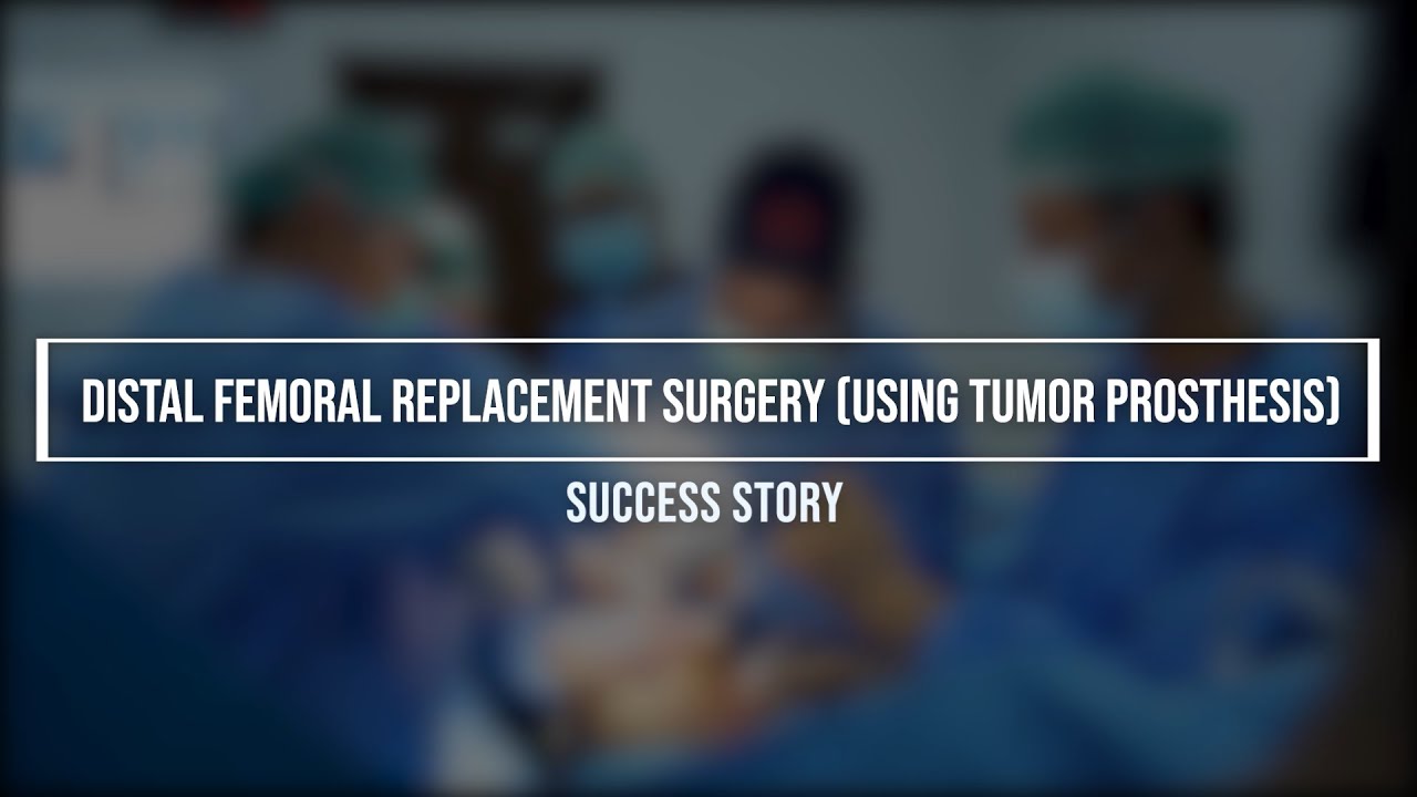 Distal Femoral Replacement Surgery (Using Tumor Prosthesis) - YouTube