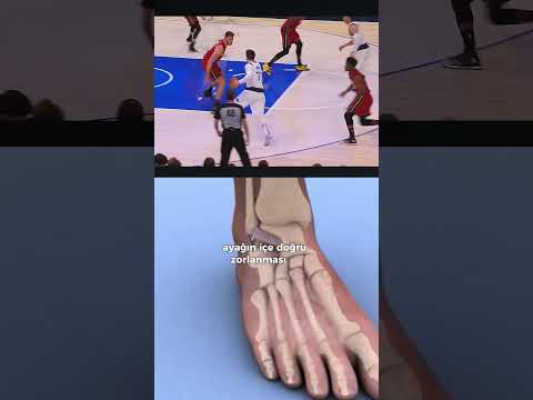 Ayak Bileği Burkulması