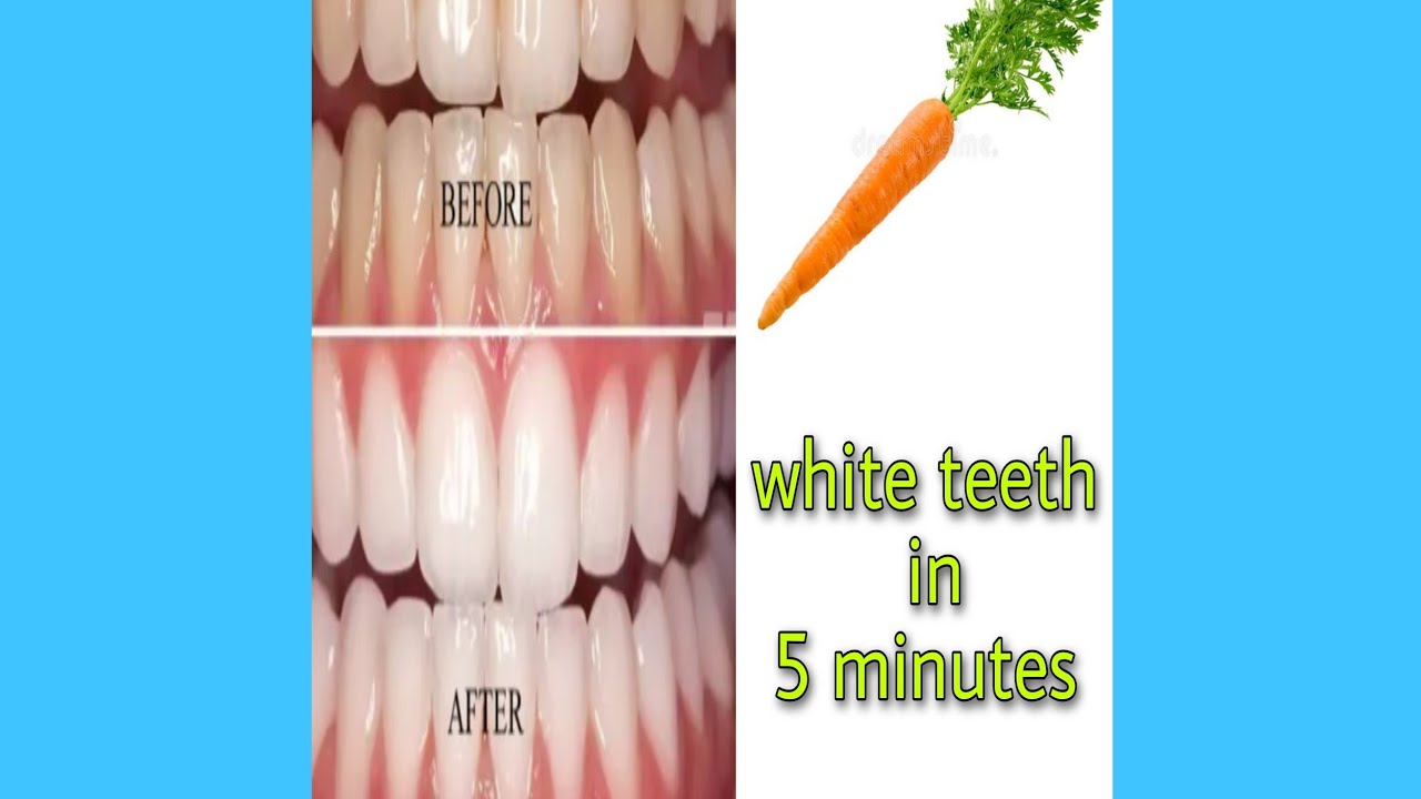 tips for white teeth - YouTube