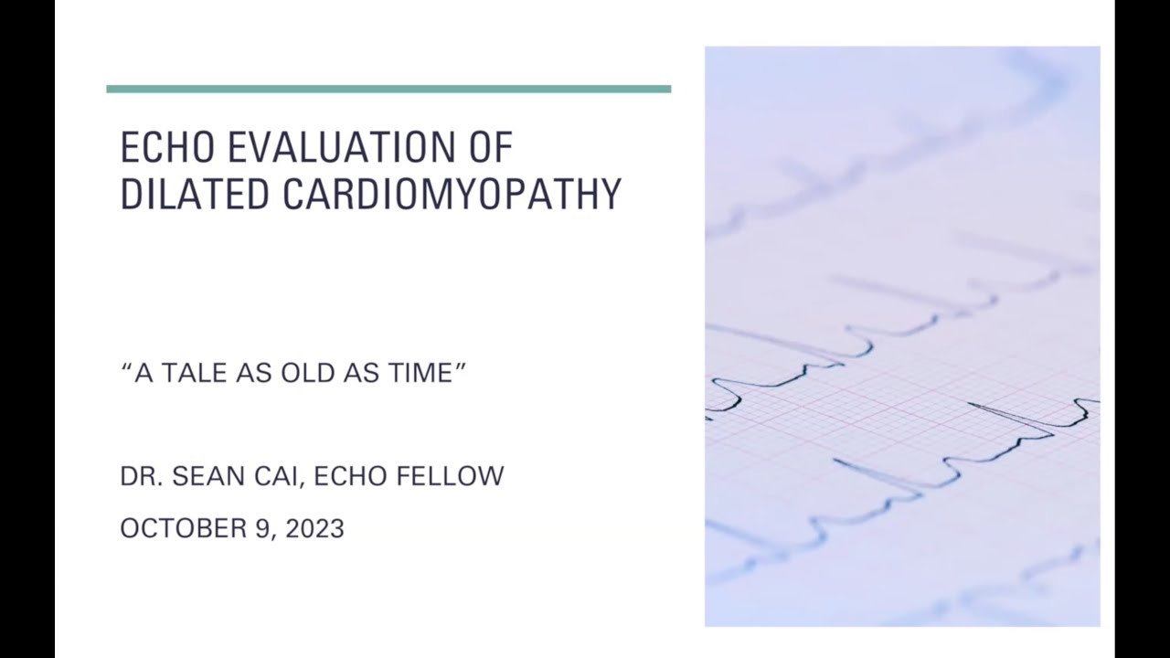 Echocardiographic assessments in dilated cardiomyopathy (DCM) - YouTube
