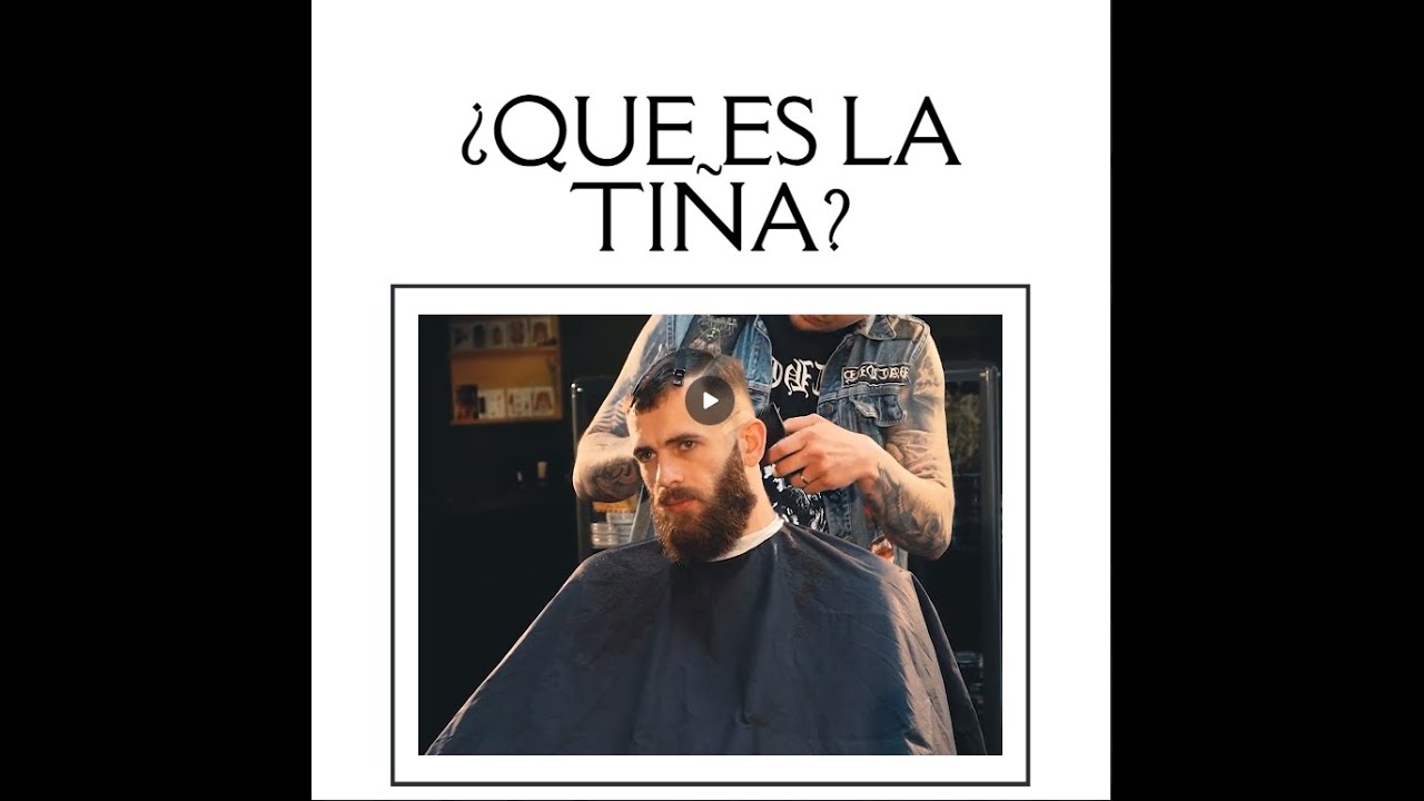 Que es la Tiña? Hongo - YouTube