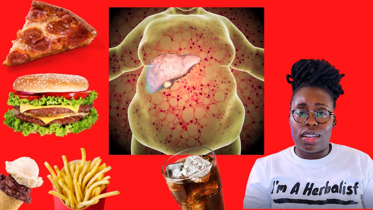 How Fast Food Effects The Body - Part 1 | How The Food You Eat Affects ...