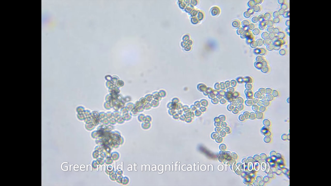 Grey/Green Mold on Shiitake Substrate - Cobweb Mold - YouTube