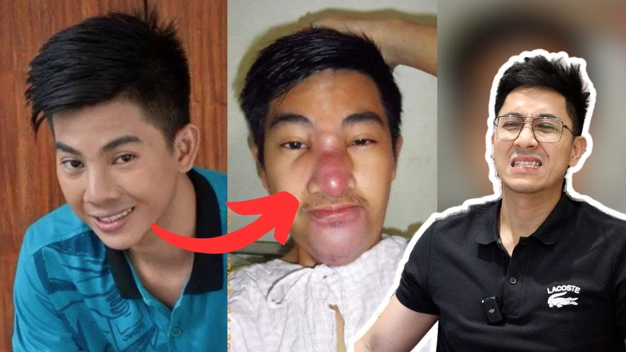 LALAKING NAGPARETOKE, NAUWI SA DELUBYO - YouTube