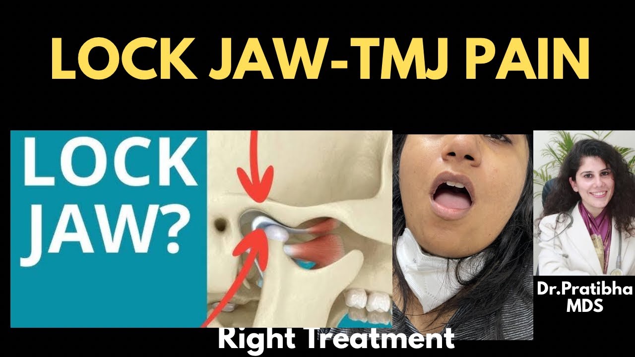 Lock Jaw from TMJ DISORDER treatment #shorts #viralvideo #trending # ...