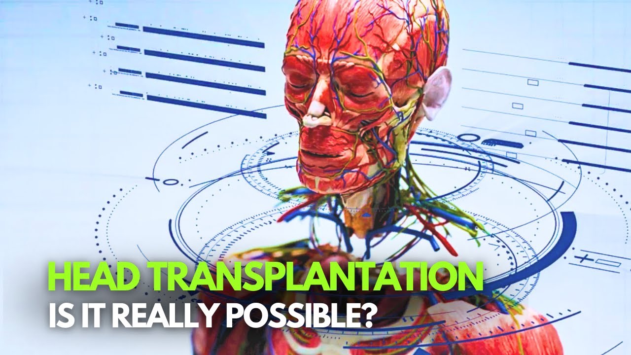 Is Head Transplantation Possible with BrainBridge? - YouTube