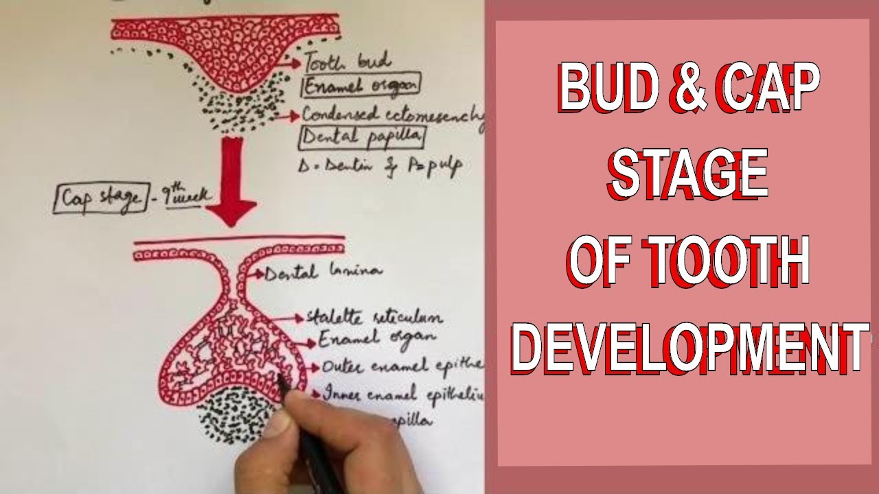 Development Of Tooth Part 1 Initiation Bud And Cap Stage Of Tooth