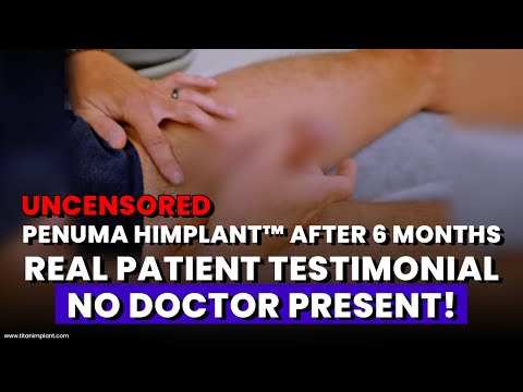 AMAZING! 6-Month Honest Penuma Implant Review | Real Patient’s Testimonial Without a Doctor Present