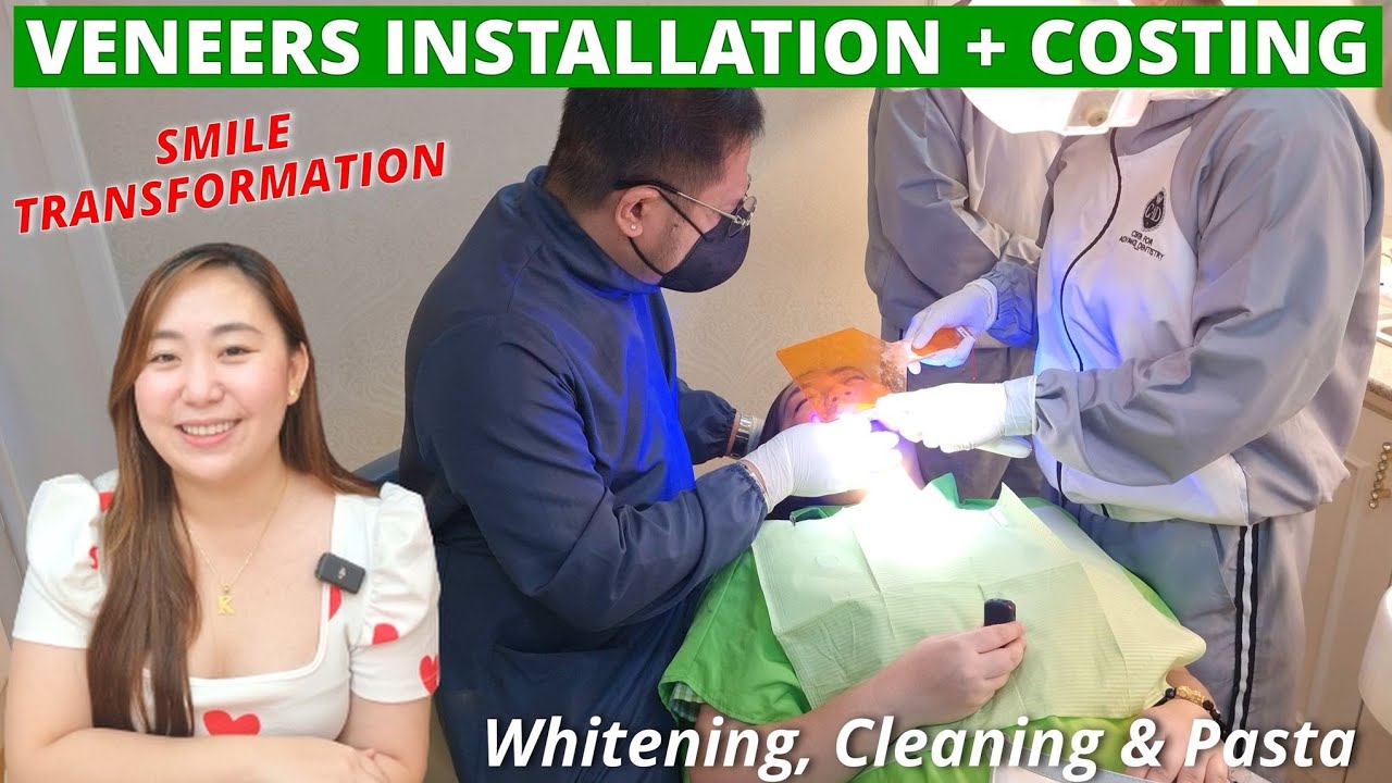 Veneers Installation & Costing! Ang Ganda at Sulit (Magkano Ang ...