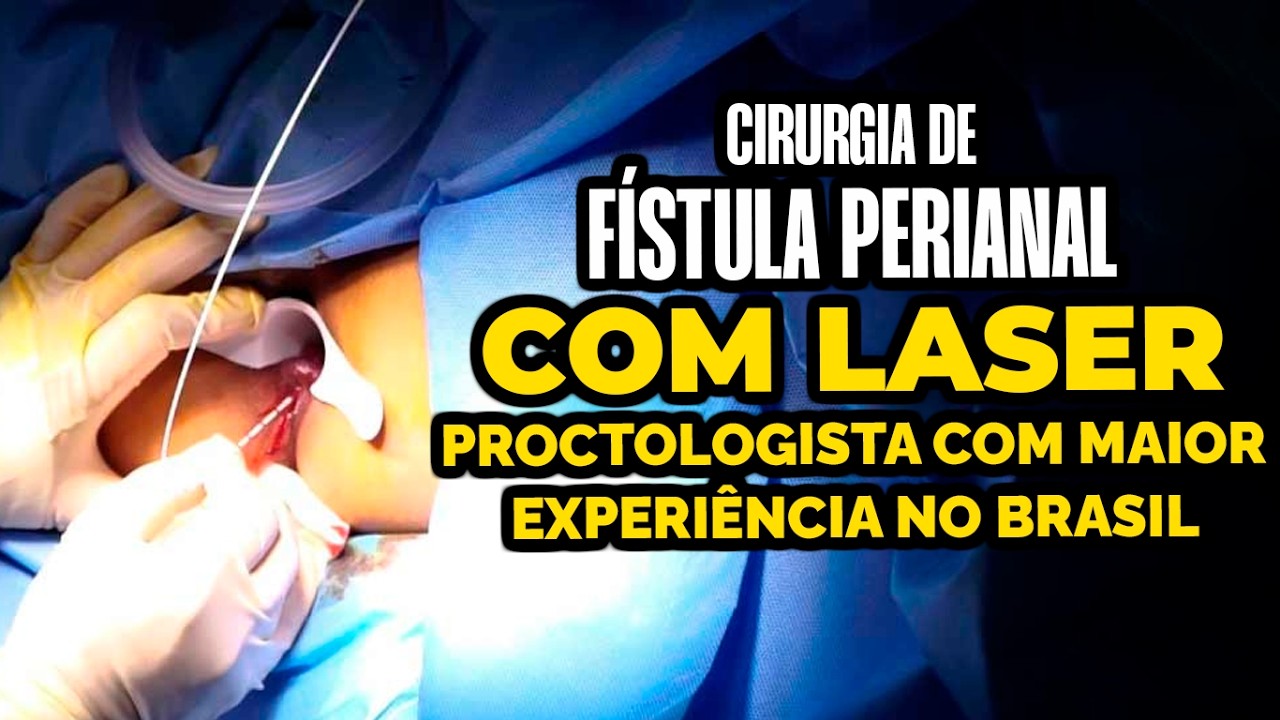 CIRURGIA DE FÍSTULA PERIANAL COM LASER PROCTOLOGISTA MAIOR EXPERIÊNCIA ...