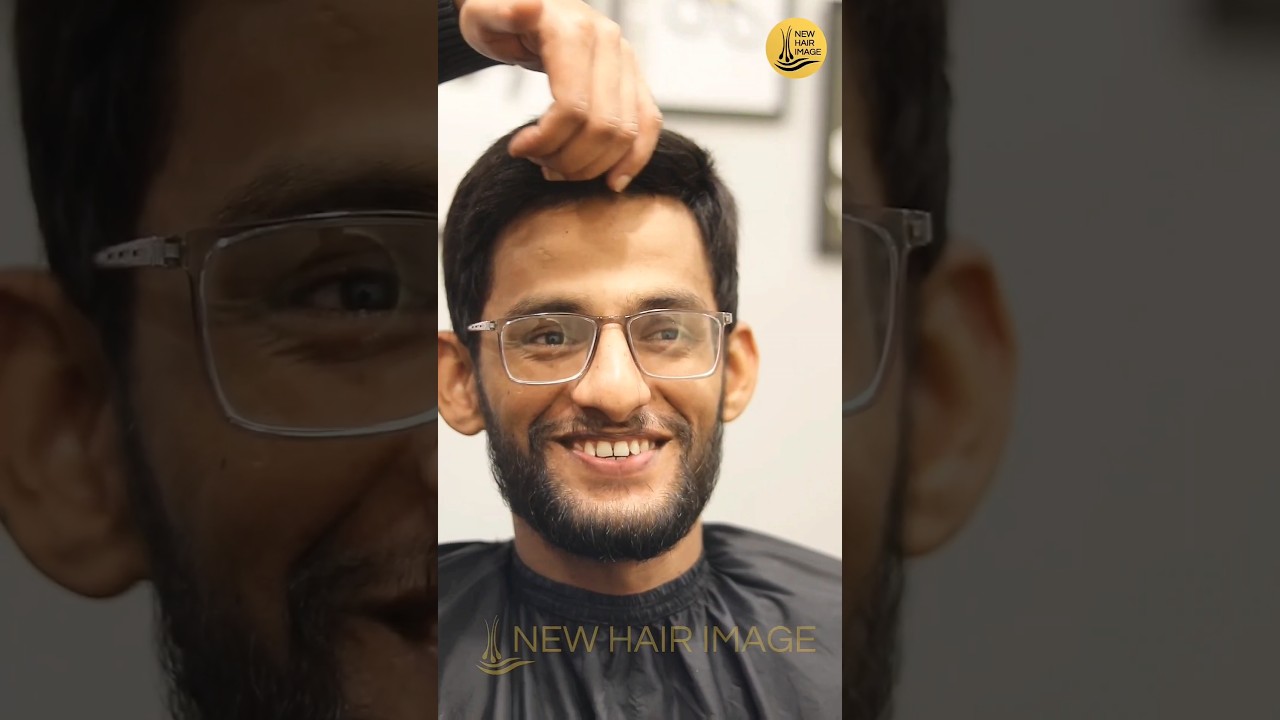 Natural Front Hair line hair system #hairpatch #hairsystem #hairgrowth ...