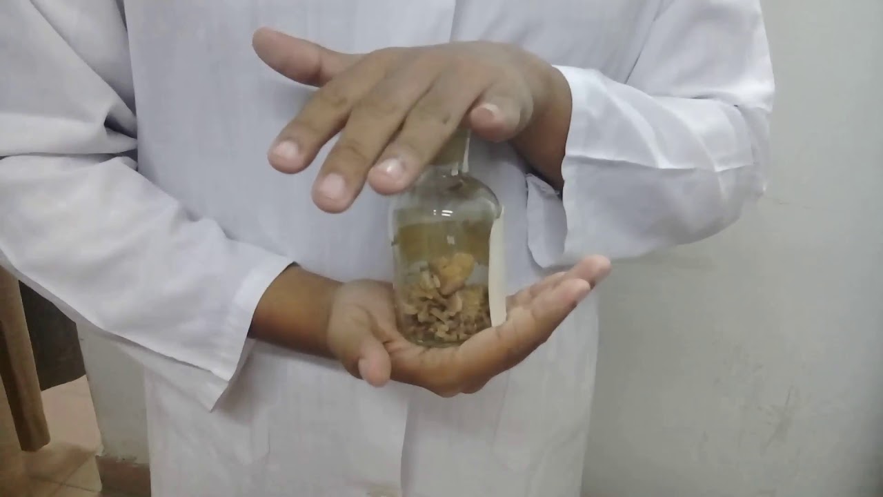 Introduction of Dhatura Poisoning ( Forensic Medicine) - YouTube