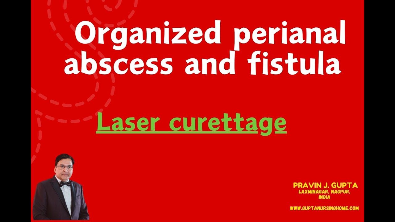 SURGERY OF ANAL FISTULA WITH ORGANIZED ABSCESS BY LASER - YouTube