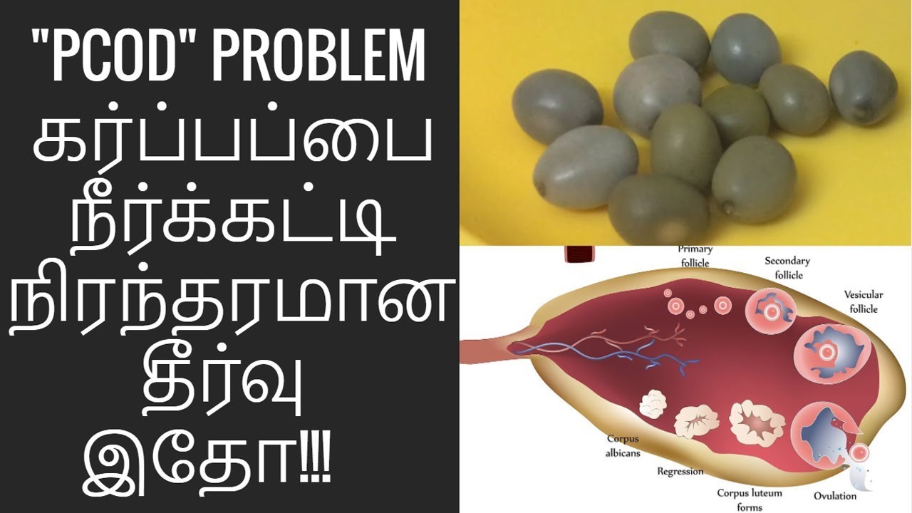 கர்ப்பப்பை நீர்கட்டிகள் நிரந்தரமாக குணமாகI PCOD problem solution in ...