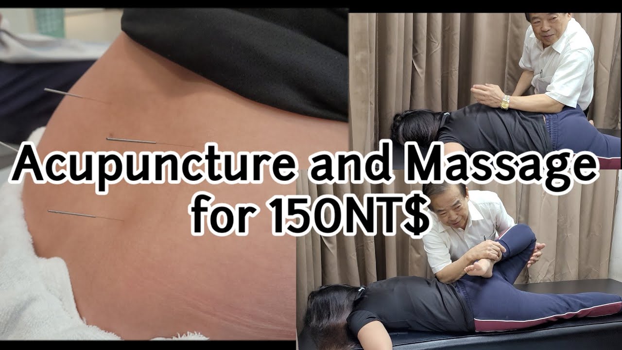 Acupuncture and Massage in Taiwan for only 150NT$| #acupuncture# ...