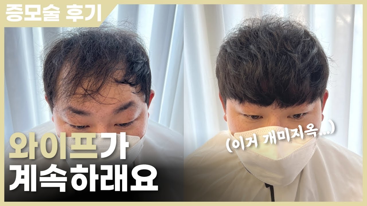 남자 탈모 붙임머리 리얼 시술 후기 헤어증모술 블랭크유 머리숱많아지는법 M자탈모 정수리탈모 Youtube