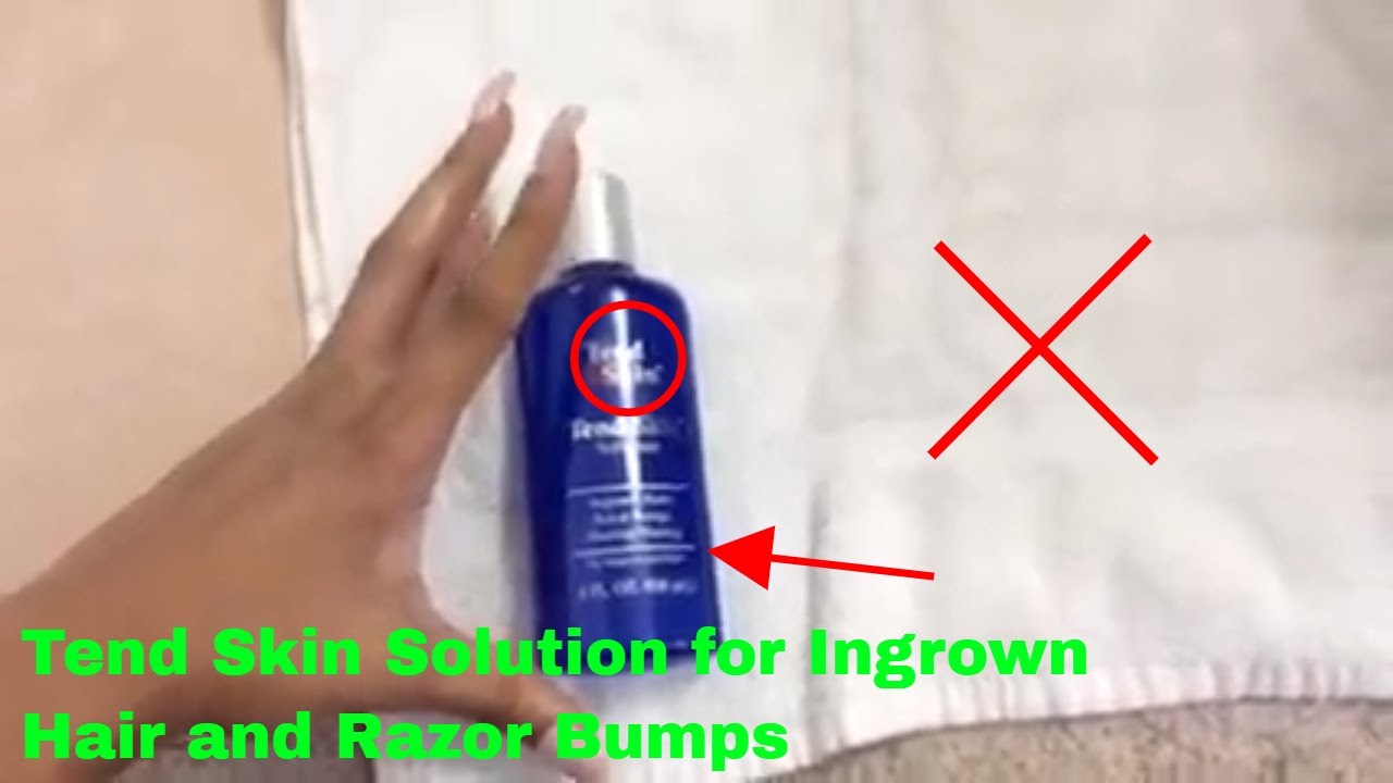 How To Use Tend Skin Solution for Ingrown Hair and Razor Bumps Review ...