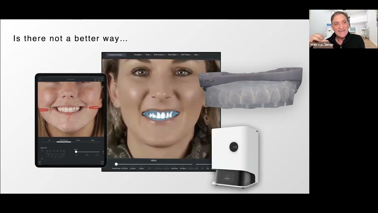From Smile Design to Smile Rehabilitation. The power of a digital ...