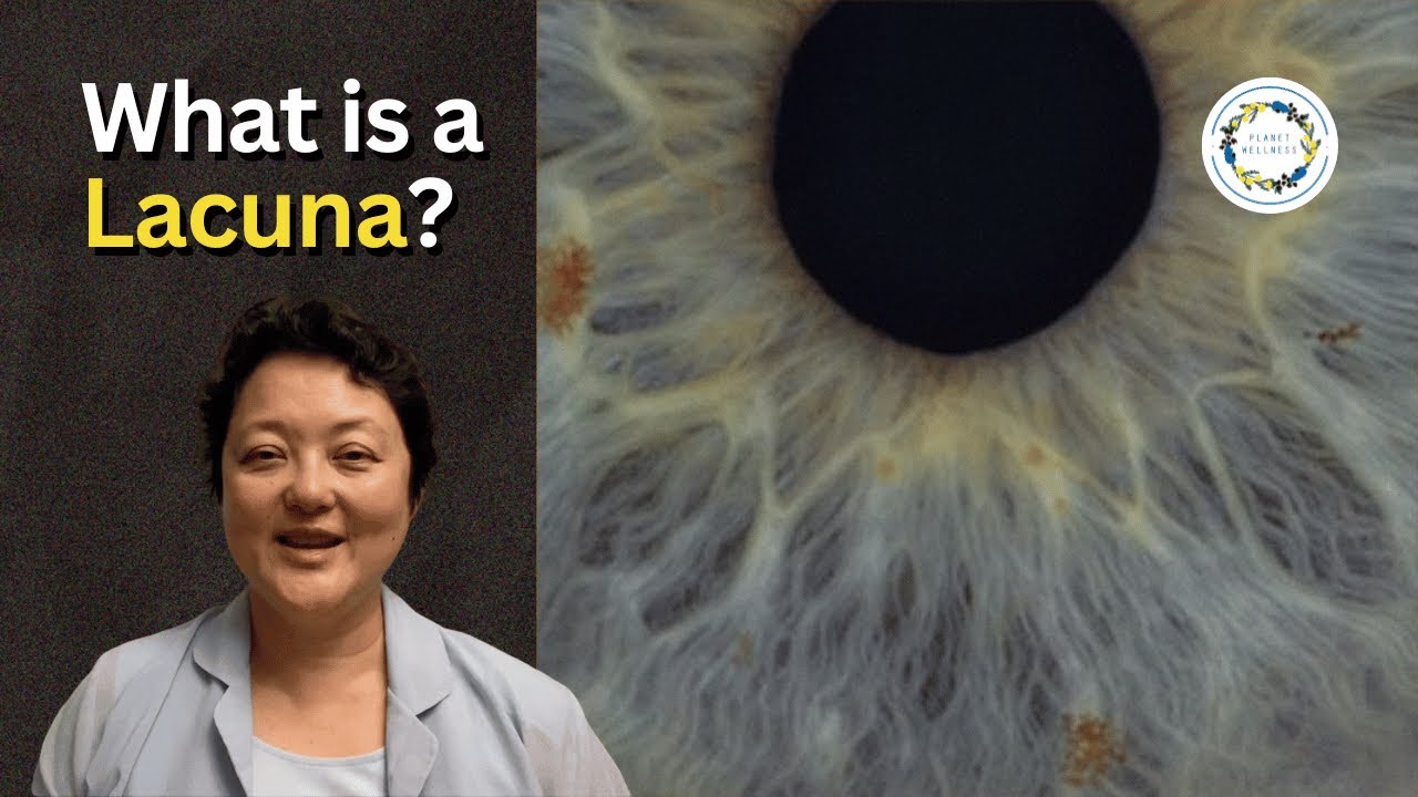 What is a Lacuna? - YouTube