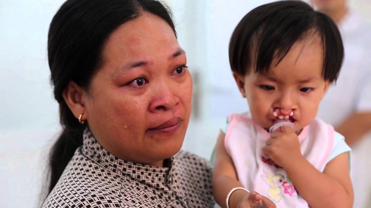 Dr. Peter Newen's Surgery Reconstruction Medical Mission - YouTube