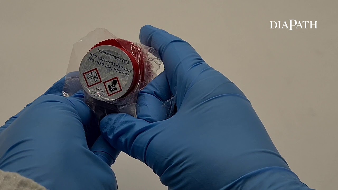 Diapath SafeCapsule: how it works. - YouTube