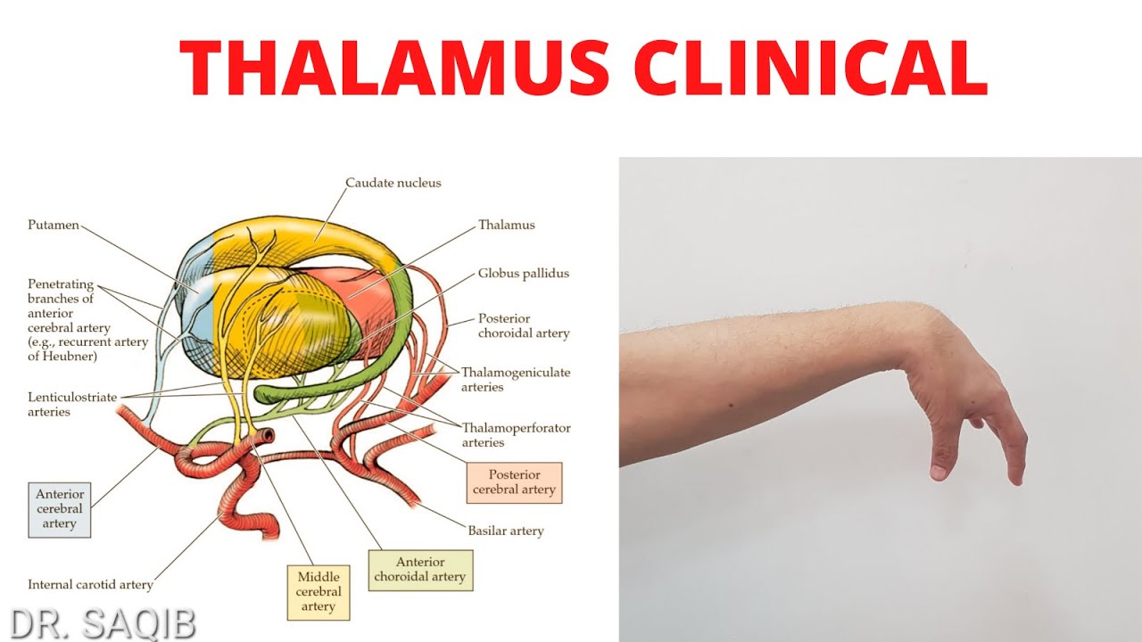 Thalamus Clinicals | Blood Supply of Thalamus | Wernicke-Korsakoff ...