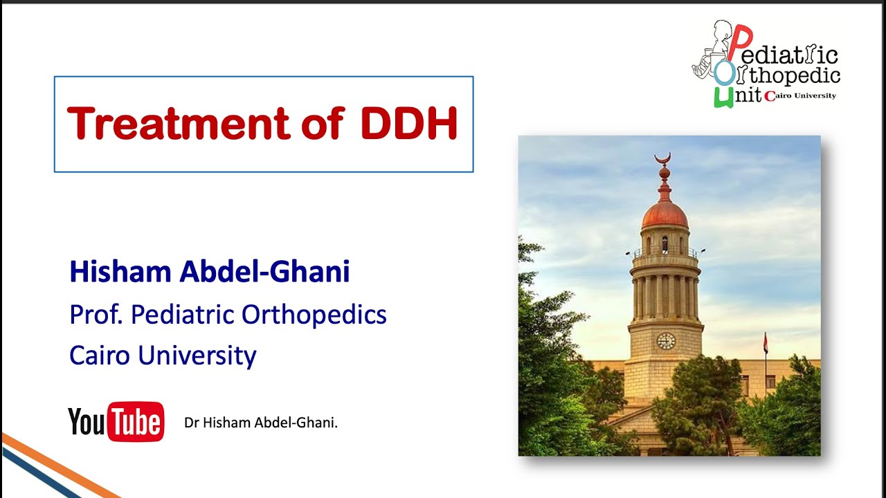 DDH part 3: TREATMENT OF DDH and Pelvic Osteotomies - YouTube