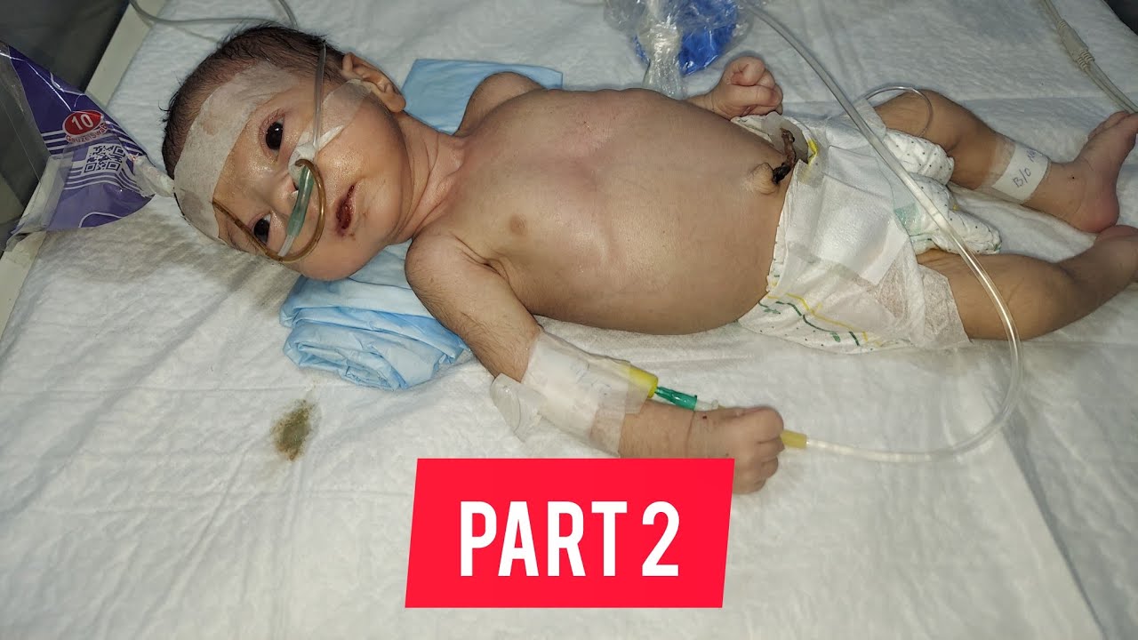 Diagnosis HIE Grade 3 in Newborn Baby | Step-by-Step NICU Management ...