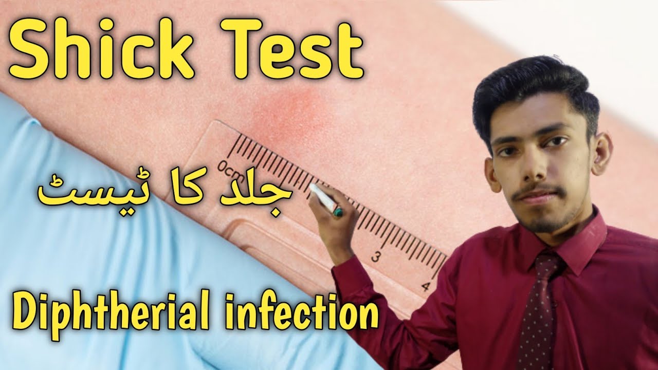 Shick Test | جلد کا ٹیسٹ | Principle and Procedure | Explained in Urdu ...