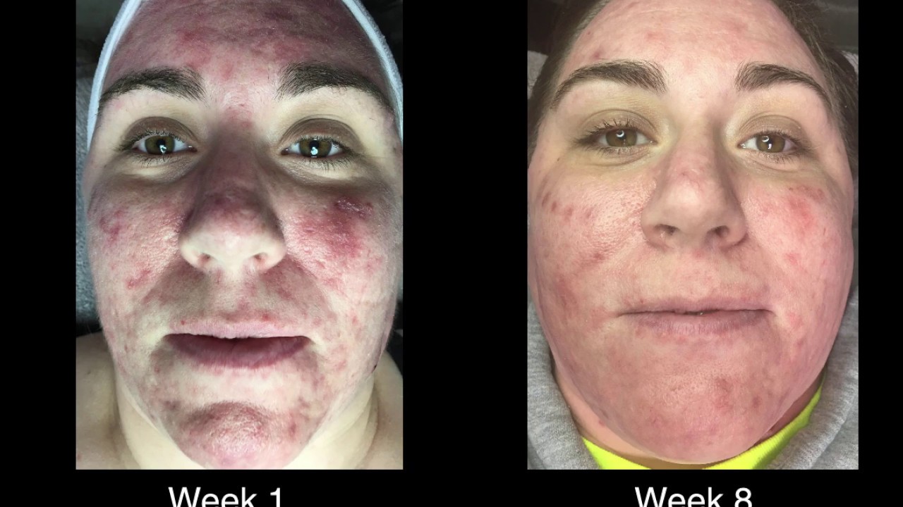 Elizabeth Steffen for The Skin Games week #8 - YouTube