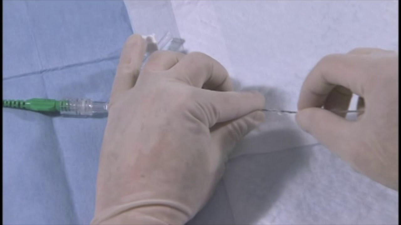 Angioplasty technique: the Basic technique of Rotablator (+English ...