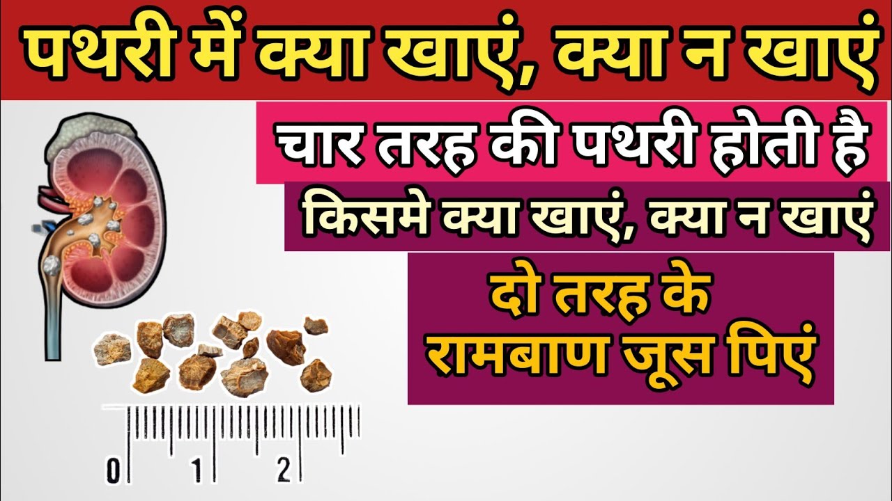 पथरी में क्या खाना चाहिए क्या नही खाना चाहिए, दो जूस पिये || Pathri me ...