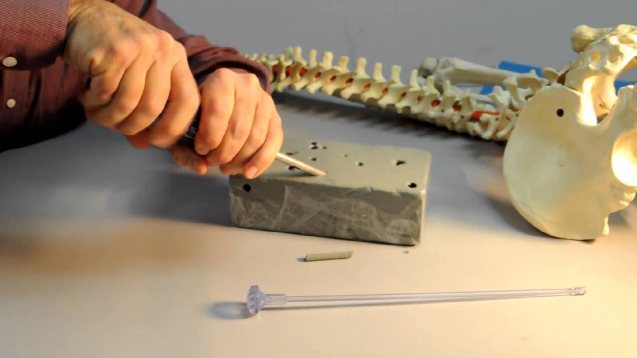 Corex HSD - Bone Harvester Trinity Orthopedics - YouTube