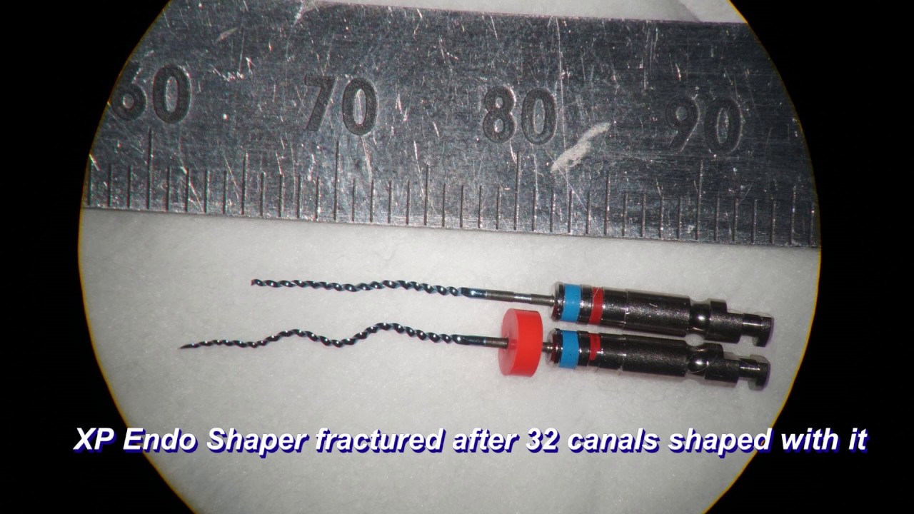 18597 removal of an XP endo shaper with ultrasonics - YouTube