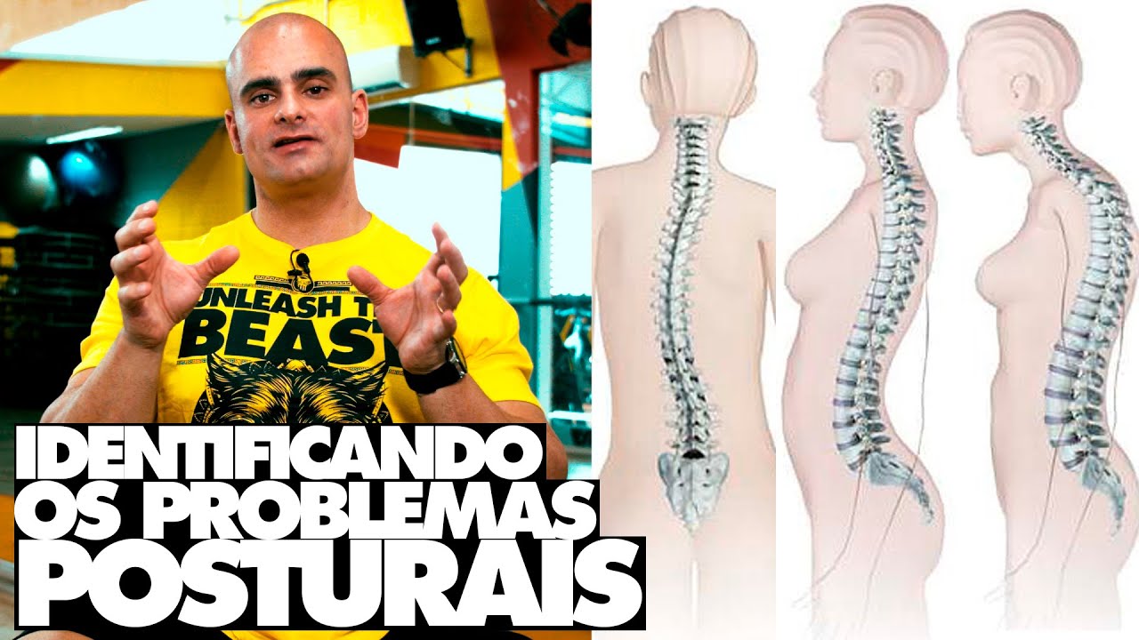 Papo com Kotolak: 3 problemas posturais e como corrigi-los através da ...