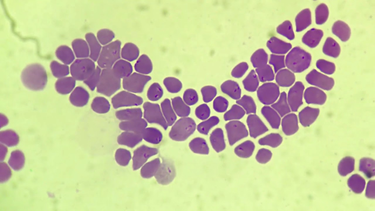 Babesia Gibsoni in blood smear - YouTube