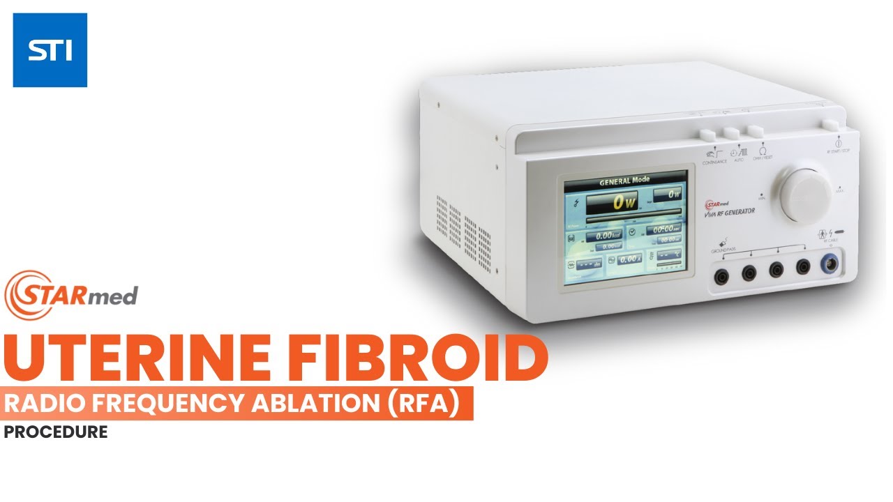 STARmed Radio Frequency Ablation - Minimal Invasive Treatment for Myoma ...