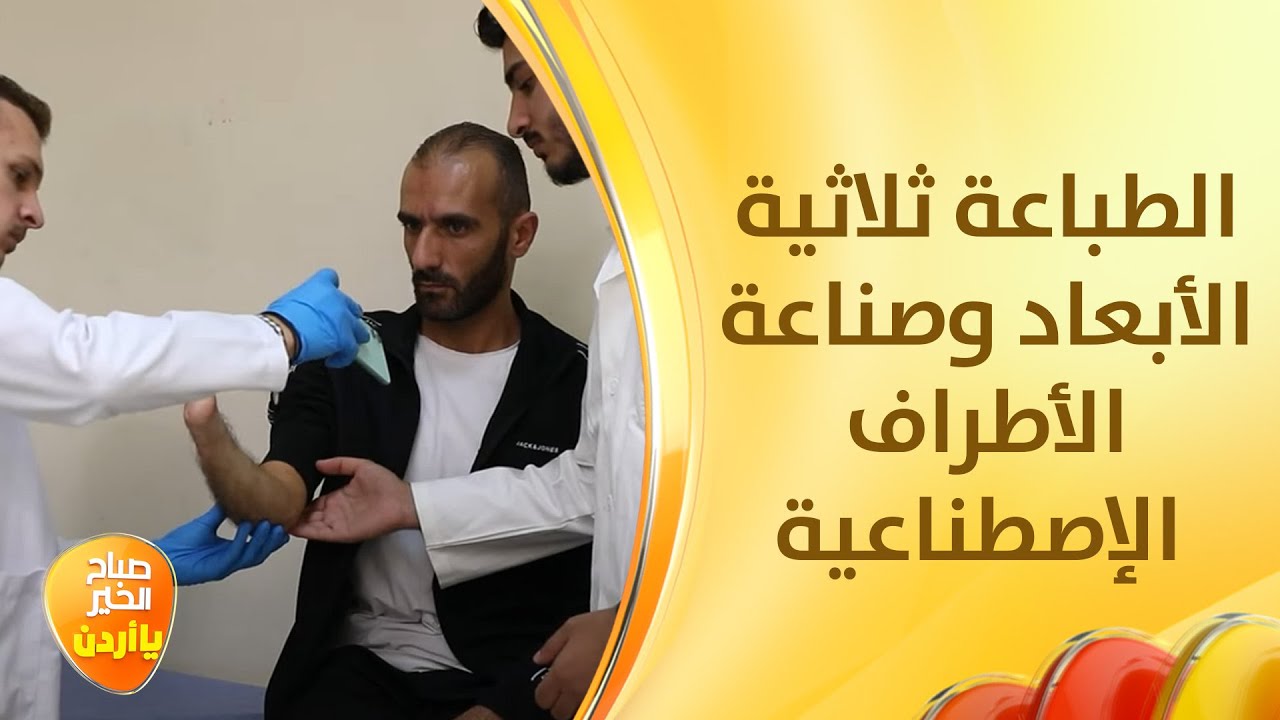 تكنولوجيا طباعة 3D تخفض كلف صناعة الأطراف الصناعية - صباح الخير يا اردن ...