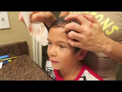 Bloody Head Split Open - YouTube