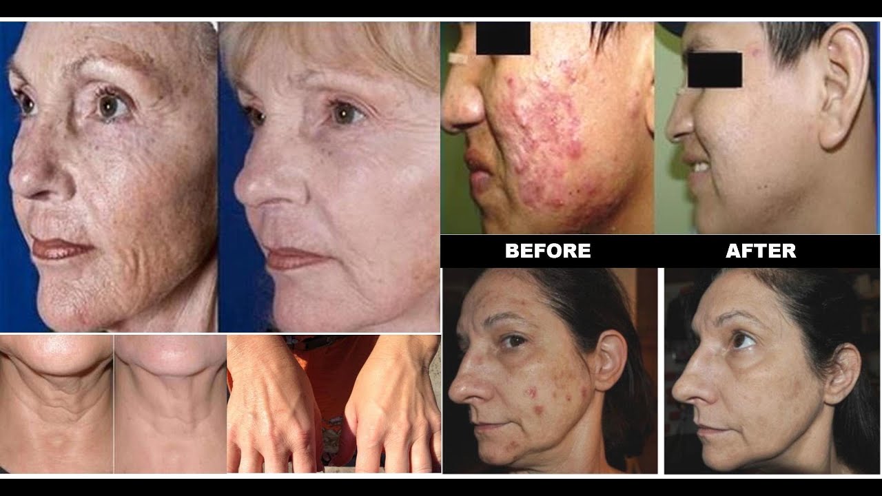 LUMINESCE™ The Secret To A Younger Healthier Looking Skin! - YouTube