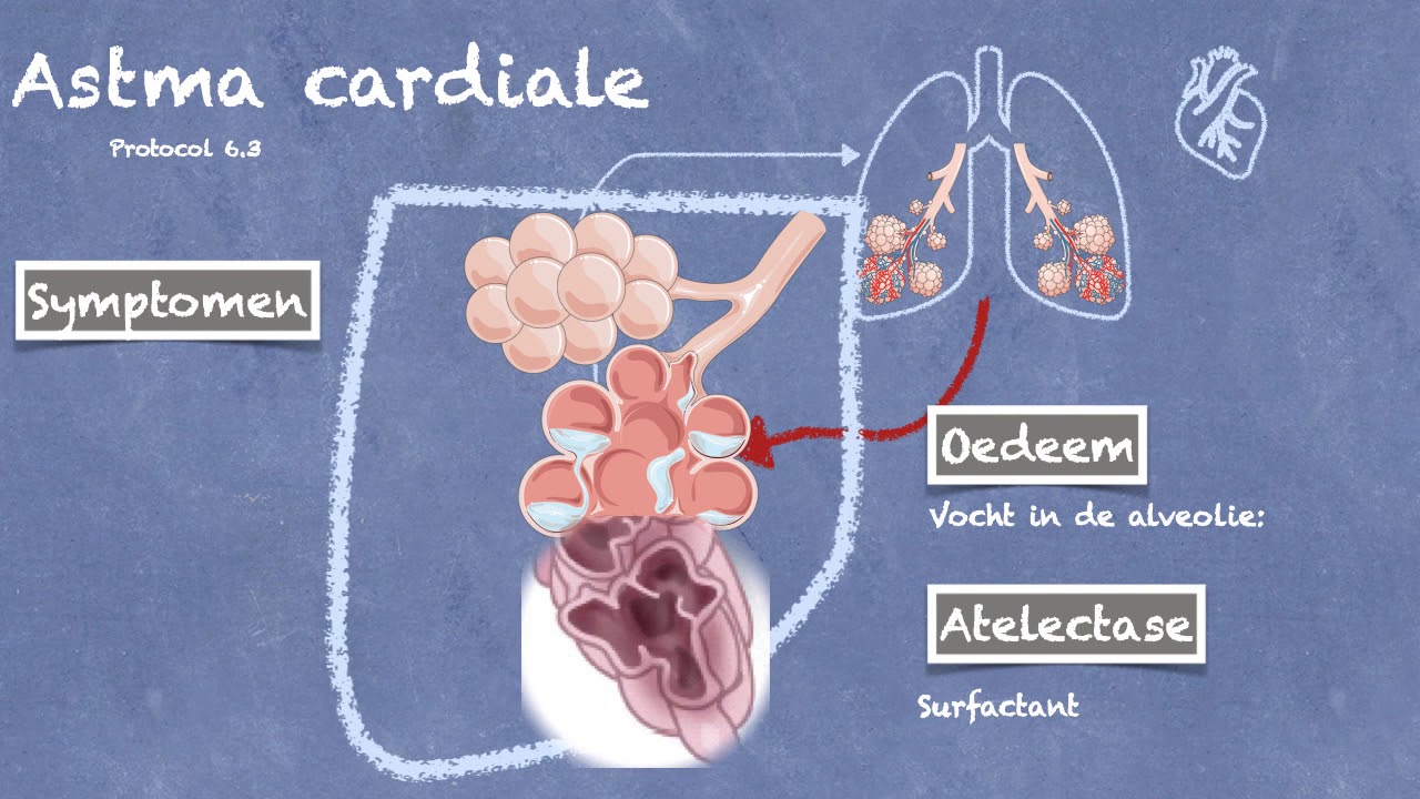Protocol 6.3 Astma Cardiale. Landelijk Protocol Ambulancezorg - YouTube